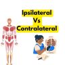 Ipsilateral Vs Contralateral Connections: A Comprehensive Medical Guide ...