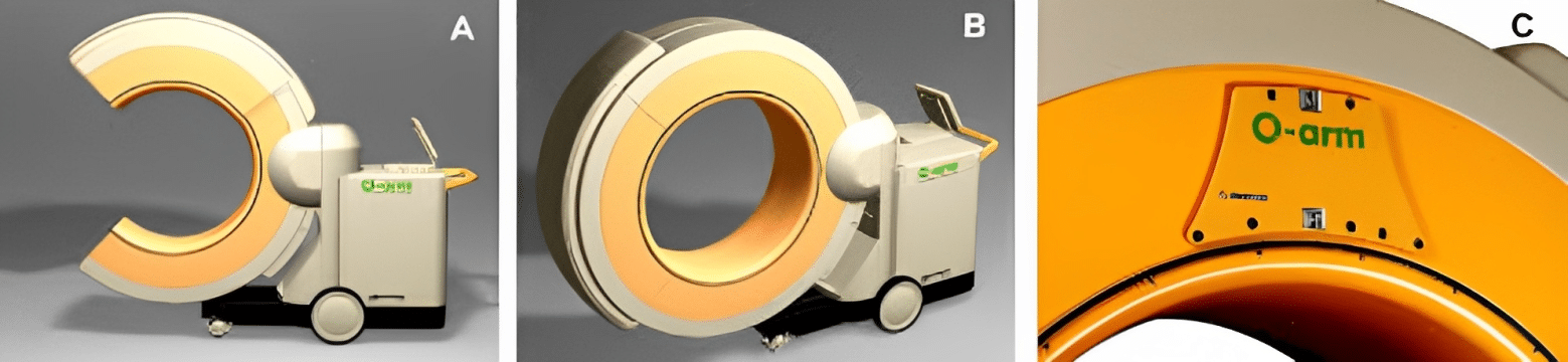 O Arm Machine: The Ultimate Tool to Transform Surgery with 3D Imaging ...